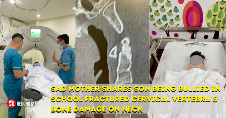 Sad Mother Shares Son Being Bullied In School Fractured Cervical ...